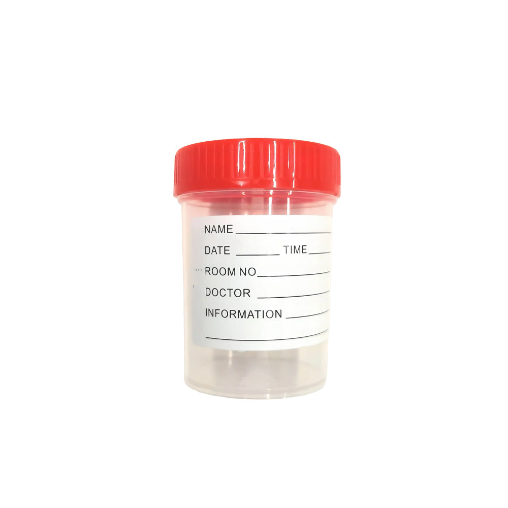 Frasco Orina Estéril - 60 ml – jfvmedical.cl